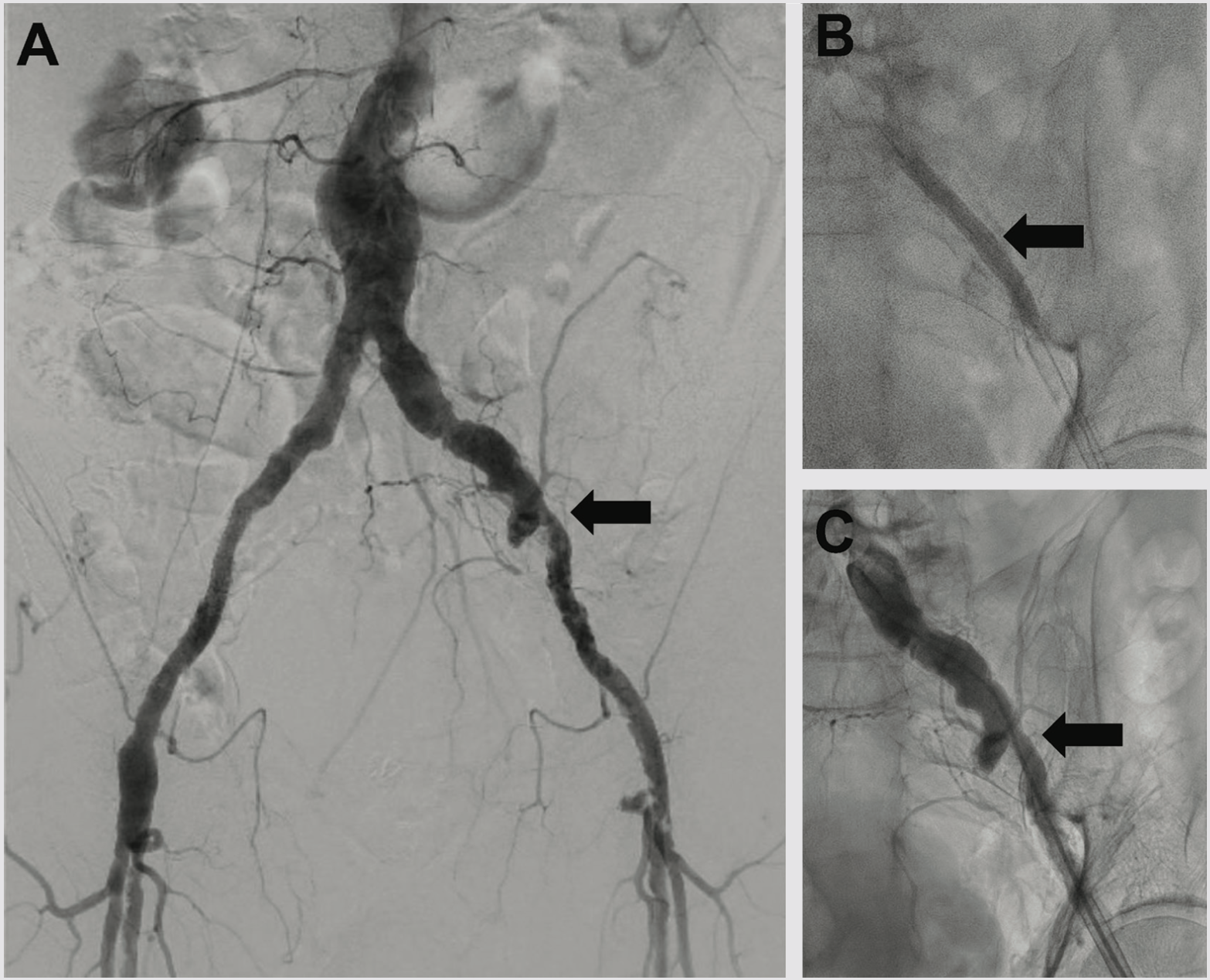 Cath Lab Digest – CathLab.com
